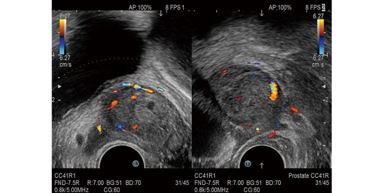 Fujifilm Arietta 650 – Streamline Your Practice